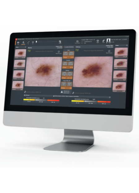 Total Body Photography and Skin Check | Skin Clinic, Australia