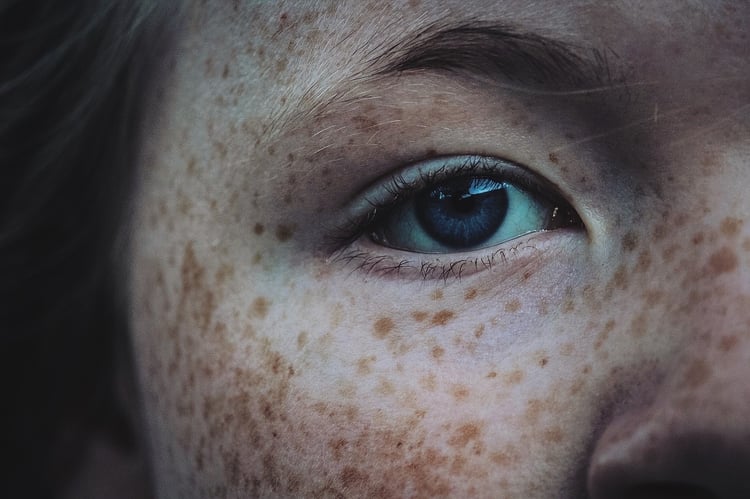 Everything you need to know about growing new moles after 30