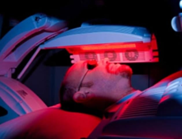 Photodynamic therapy for skin cancer treatment