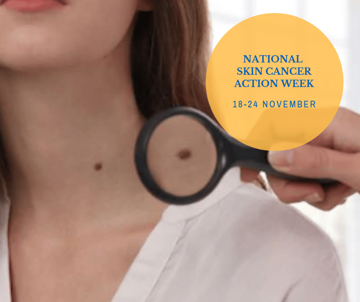 National Skin Cancer Action Week 2018
