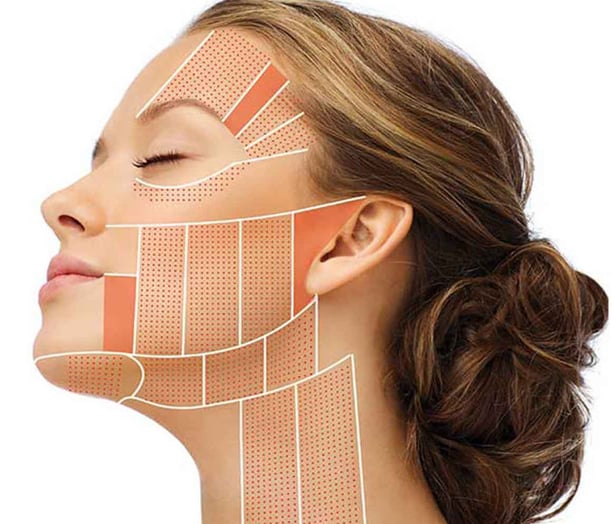 HIFU ultrasound skin tightening | National Skin Cancer Centres