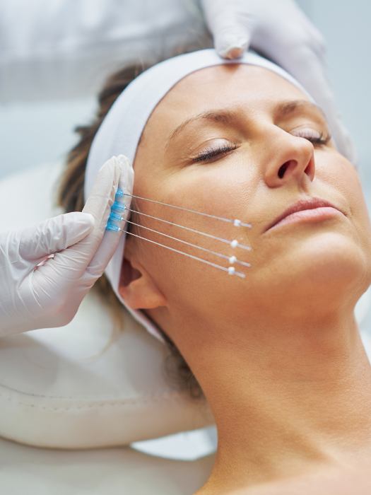 Thread lift | National Skin Cancer Centres