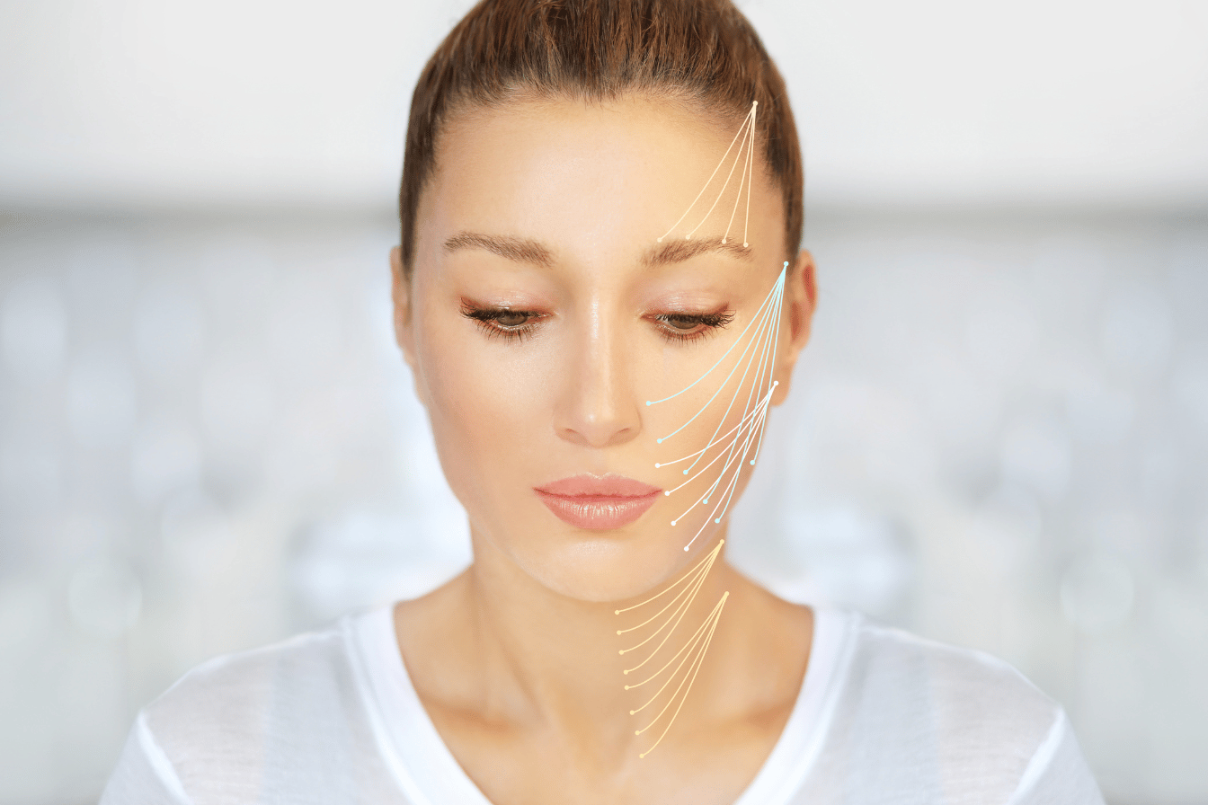 Thread lift | National Skin Cancer Centres