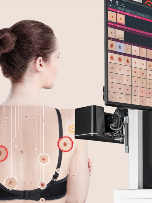 Total Body Photography and Skin Check | Skin Clinic, Australia