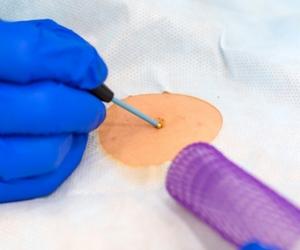 Skin Cancer Treatments | Skin Clinic, Australia