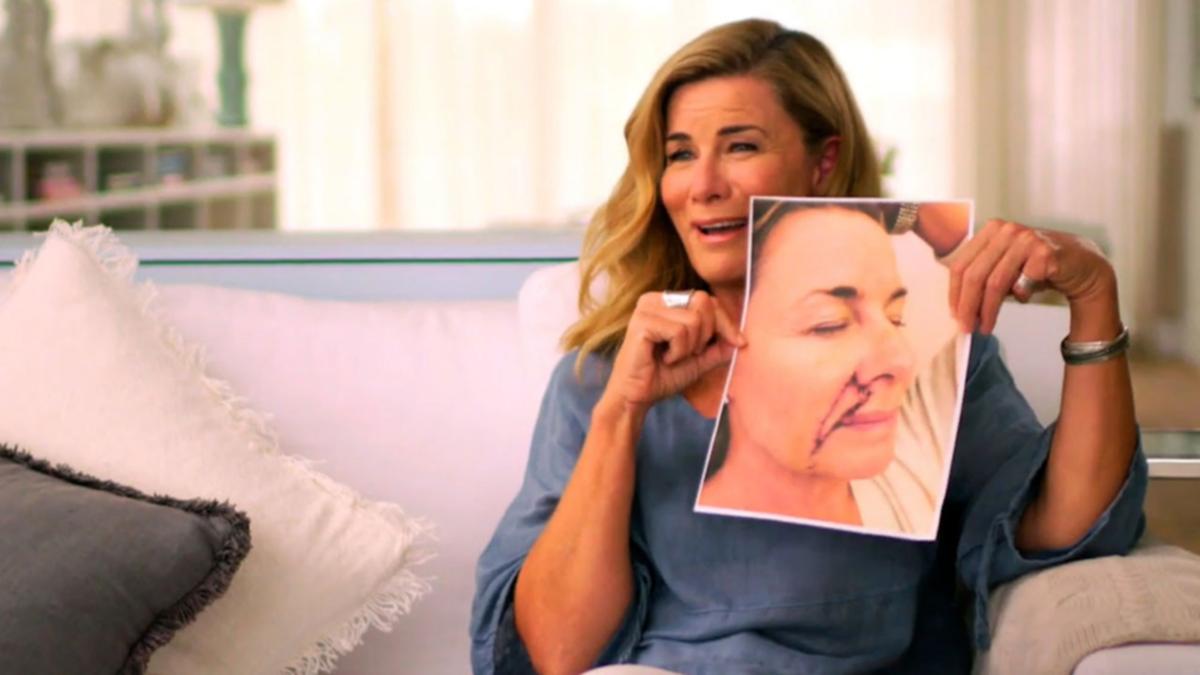 "Don't put it off": Deborah Hutton's skin cancer story