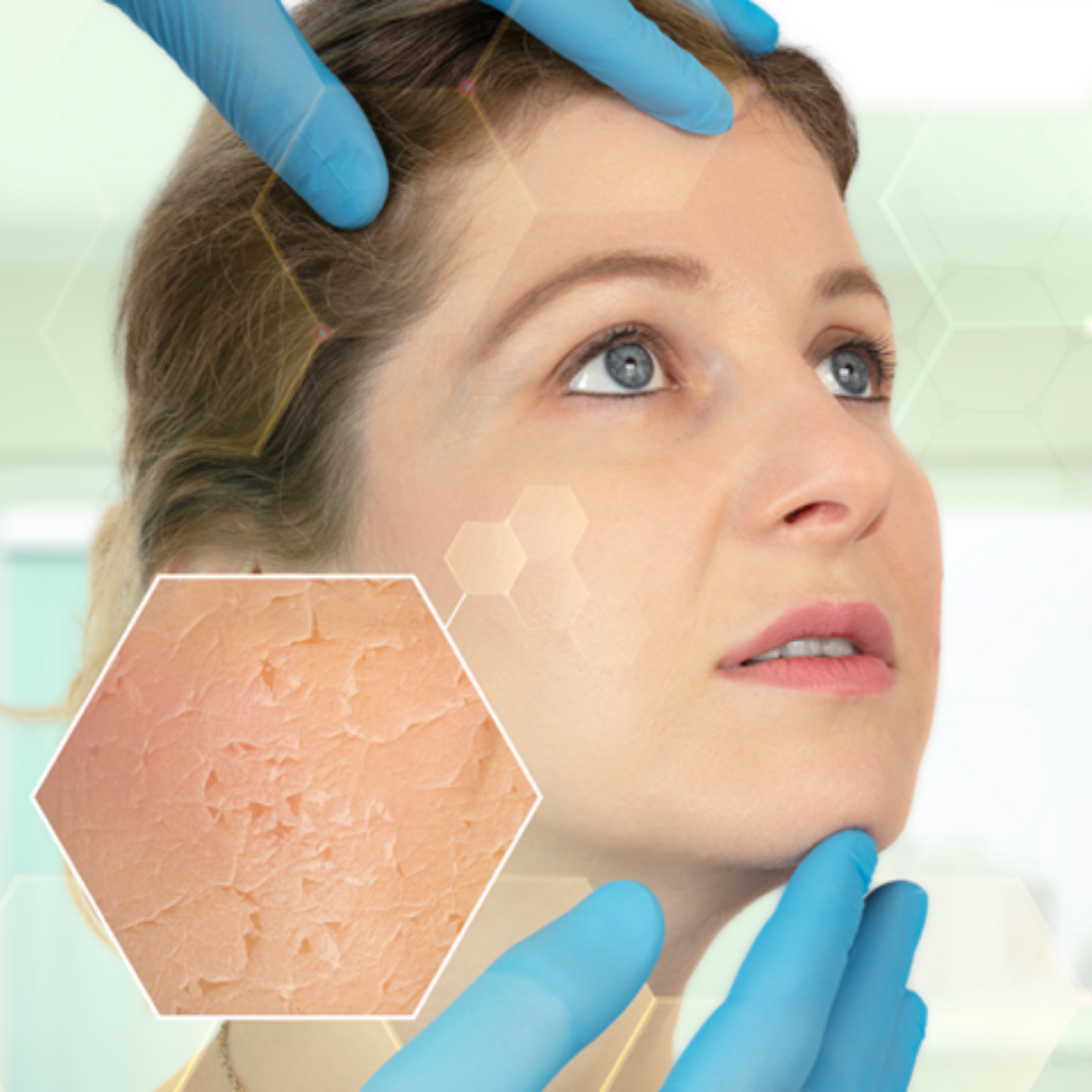 What causes dead skin cell build-up and how can you treat it?