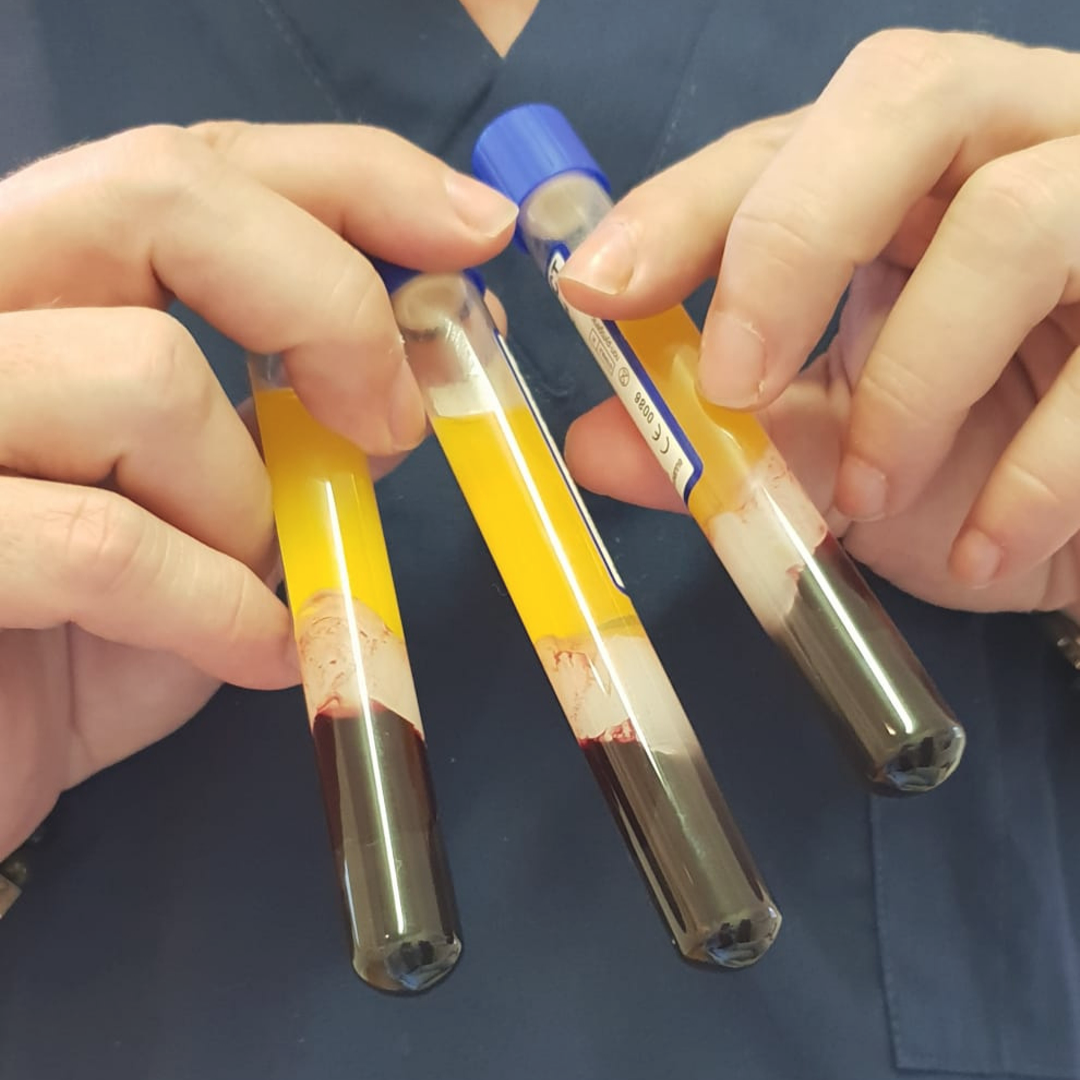 Liquid Gold Facelift: How it works