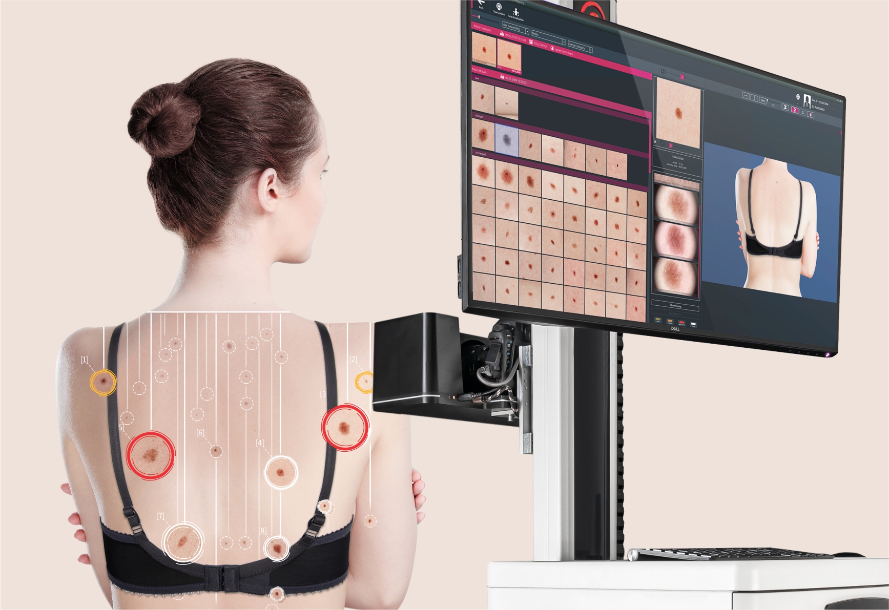 Why add total body photography to your skin cancer check?