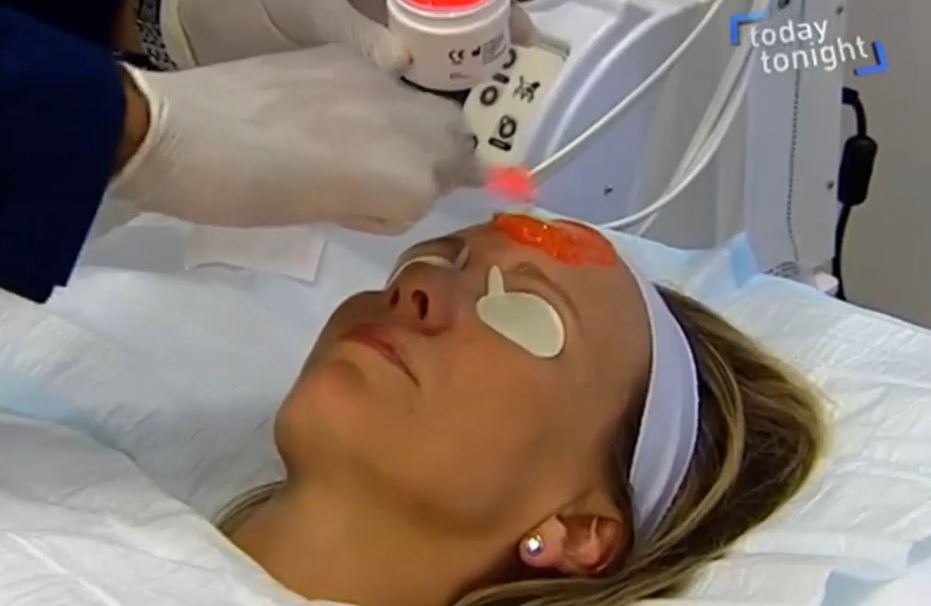 Reduce Large Pores and Acne with Kleresca