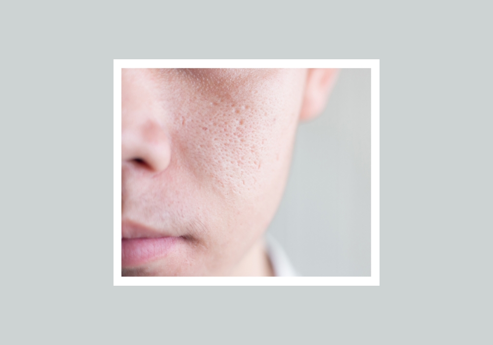 How to clean your pores
