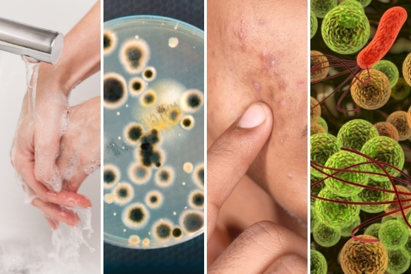 How to maintain a healthy skin microbiome