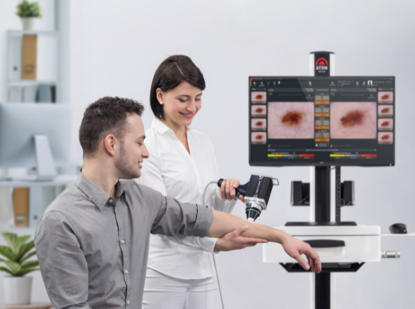 How can total body photography help with early skin cancer detection?