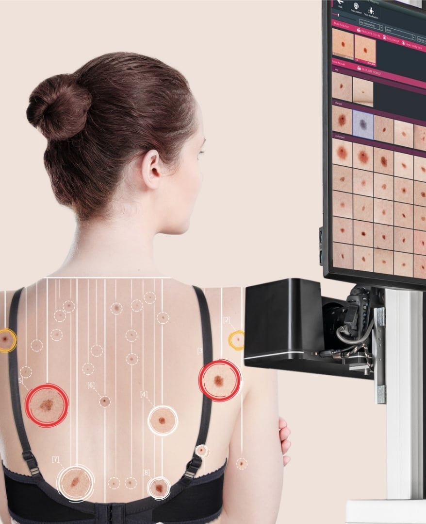 Total Body Photography and Skin Check | Skin Clinic, Australia